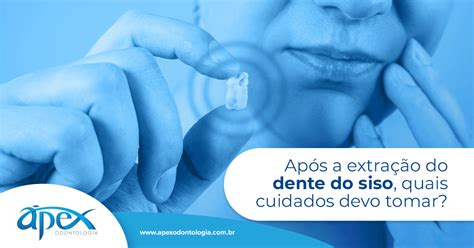 Após A Extração Do Dente Do Siso Quais Cuidados Devo Tomar Ápex