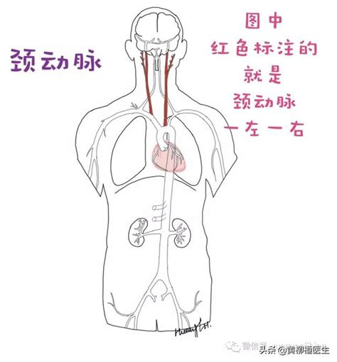 體檢發現頸動脈有斑塊怎麼辦？ 每日頭條