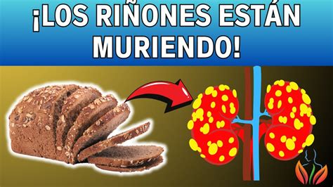 Estos Alimentos Que Debes Evitar Y Que ESTÁN DESTRUYENDO Tus Riñones Vida Saludable YouTube