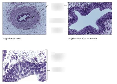 Diagram Of Lab Exam Histology Urinary Bladder Quizlet