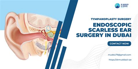 Exploring Endoscopic Ear Surgery A Minimally Invasive Technique For