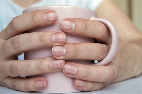 انتباه 9 علامات في الأظافر تدل على نقص الفيتامينات جمالك