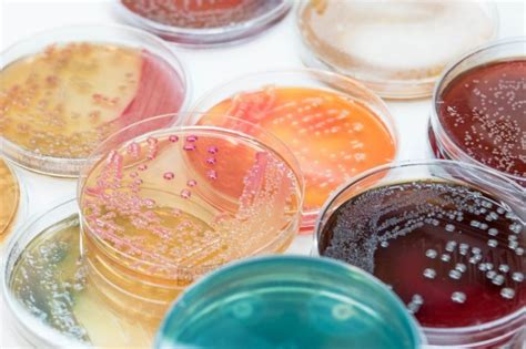 Winning The Battle Against Pathogens Meatpoultry