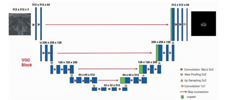 基于Vgg16 Unet模型的MRI图像下前列腺分区智能分割研究