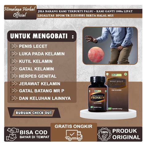 Jual Obat Penis Gatal Gatal Kelamin Kulit Bentol Infeksi Ruam Merah