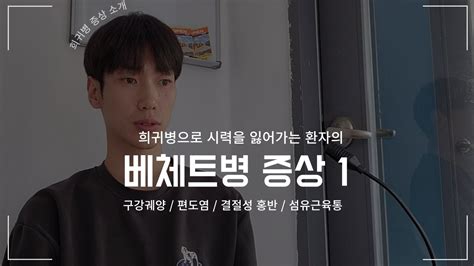 베체트병 증상 및 합병증 후기 1 Youtube