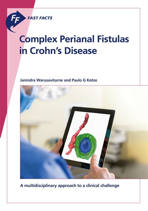 Fast Facts Complex Perianal Fistulas In Crohns Disease Ebook By J