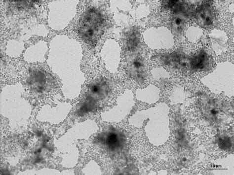 Aggregative Adhesion Pattern Exhibited By P Mirabilis Strain Isolated