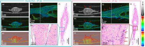 The Jm Oct In Comparison To The Histology Results For The Second