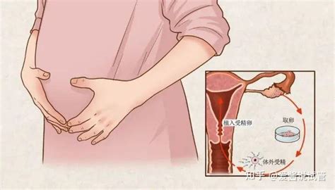 胚胎移植，什么时候才是好时机？ 知乎