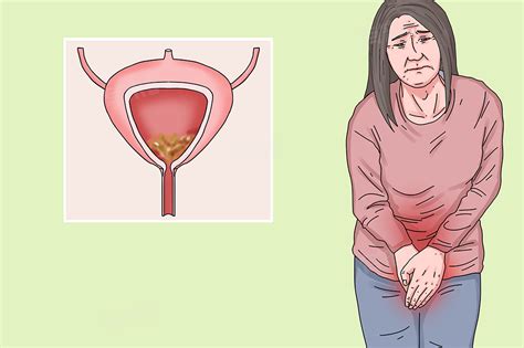 腺性膀胱炎会癌变吗