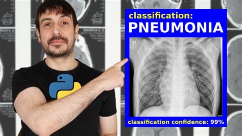 Image Classification Web App With Python And Streamlit Pneumonia