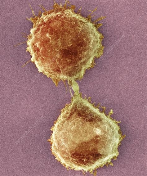 Cell Division Sem Stock Image C001 7634 Science Photo Library