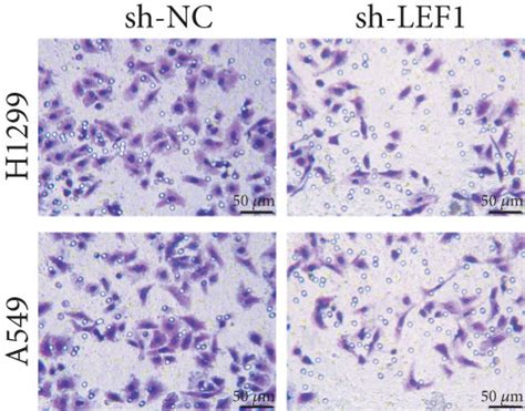 Lef1 Knockdown Inhibits The Migration And Invasion Of Nsclc Cells A