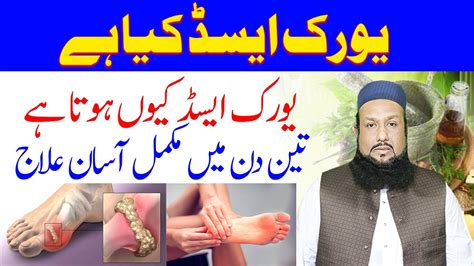 Uric Acid Ka Ilaj High Uric Acid Treatment How To Reduce Uric Acid