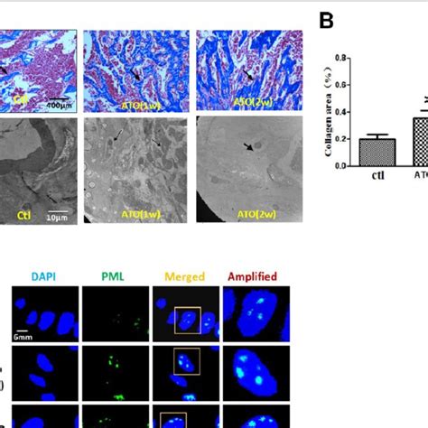 ATO promotes collagen synthesis and stimulates PML-NBs formation in ...