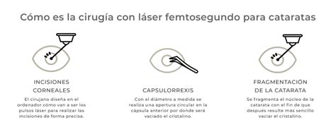 Láser Femtosegundo Para Cirugía De Cataratas Clínica Rahhal
