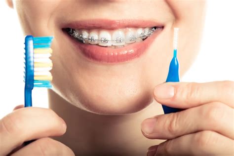 A Guide To Cleaning Teeth With Braces Orthodontic Associates