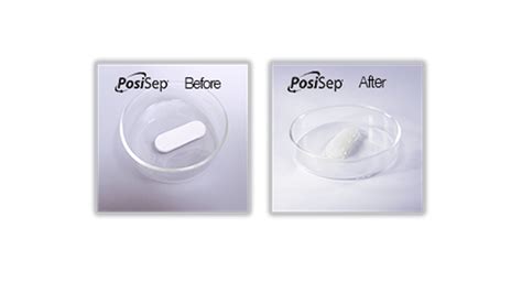 Posisep® Bx 5 Ea Ent Supplies