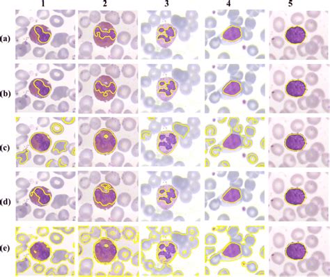 Visual Comparison Of The Proposed Method With Expert Segmentation And