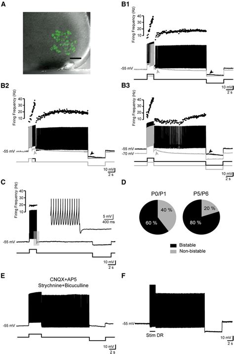 Electrophysiological Properties Of Plateau Potentials A Confocal Download Scientific Diagram