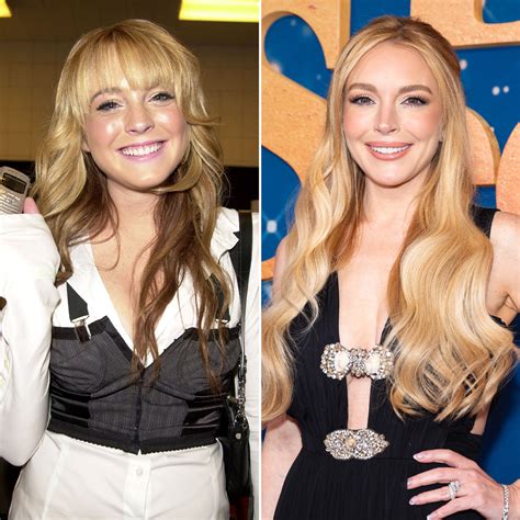 Did Lindsay Lohan Get Plastic Surgery Transformation Photos Life And Style