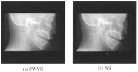 Figure 11 From Frequency Domain Volume Rendering By The Wavelet X Ray Transform Semantic Scholar