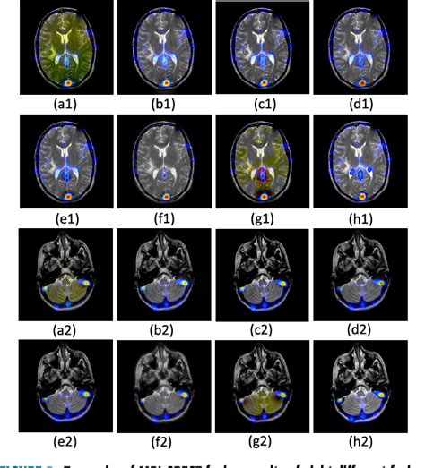 Figure 1 From A Novel Ga Based Optimized Approach For Regional Multimodal Medical Image Fusion