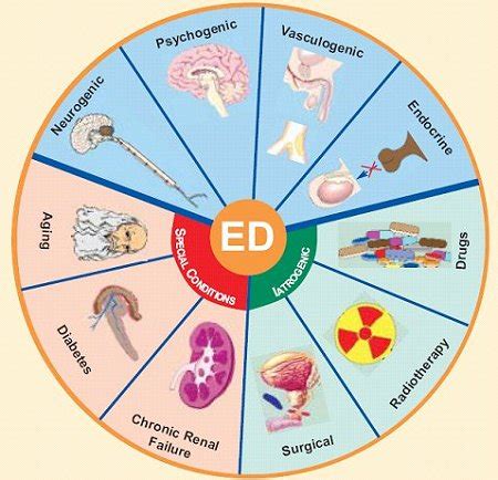 Causes Of Ed News24