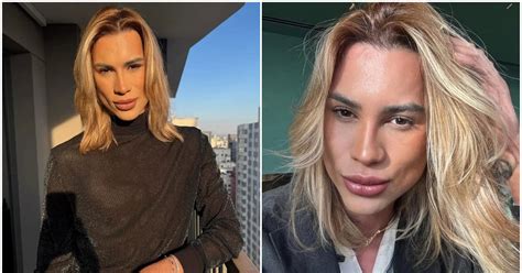 Operația Estetică Pentru Ochi De Vulpe” I A Adus Moartea Unui