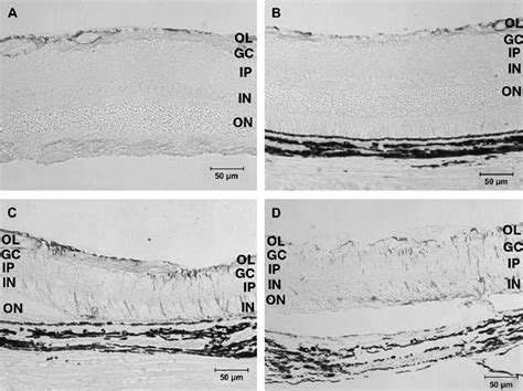 Immunostaining For Gfap Retinal Cross Sections Are Shown With Gfap