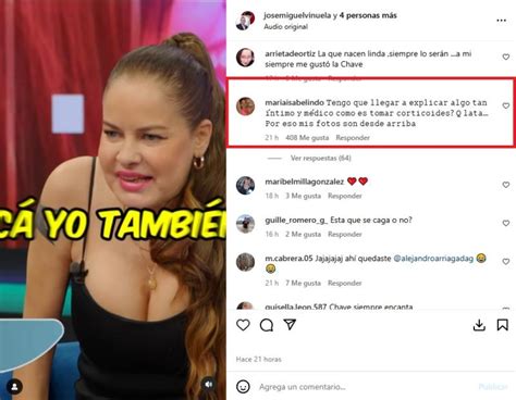 Chabe Reaccionó A Crueles Comentarios Sobre Cambio En Su Rostro