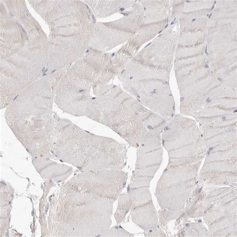 Rabbit Polyclonal Anti Csk Antibody Buy For Research Highly