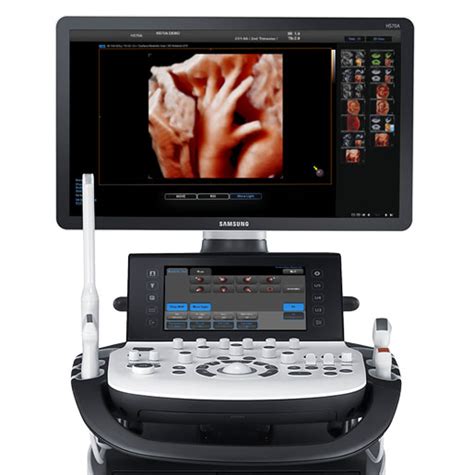 3d4d Ultrasound Shaahid Scans Best Scans In Chennai
