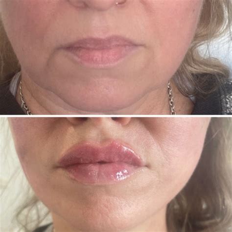 Best Pdo Threads New You Beauty Lab