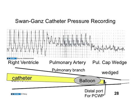 10 29 08 A Cardiac Hydraulics