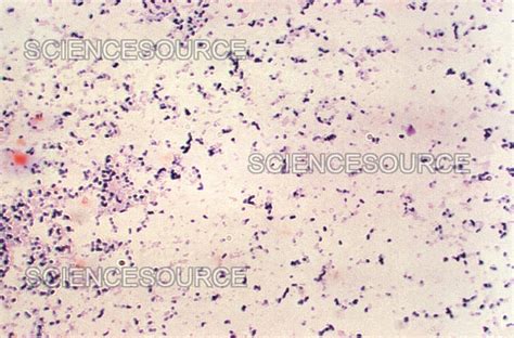 Peptostreptococo Peptostreptococo