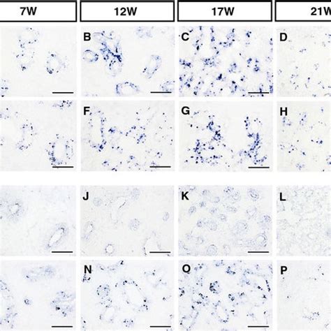 Expression of canonical WNT β CATENIN signaling ligands in the
