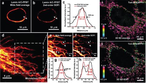 Sofi Nanoscopy Of Subcellular Structures Labeled With Small Download Scientific Diagram