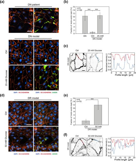 Permeability Analysis In Senescent Models Of Endothelial Cell