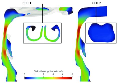 Magnitude Of The Airflow Velocity Ms Of A Cross Sectional Area Along
