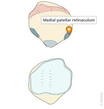 Medial Patellar Retinaculum E Anatomy Imaios