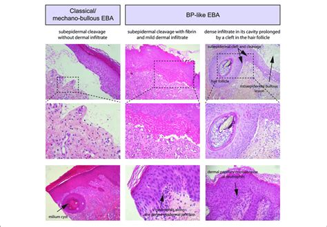 Standard Histology Left Histological Study Of Lesional Skin