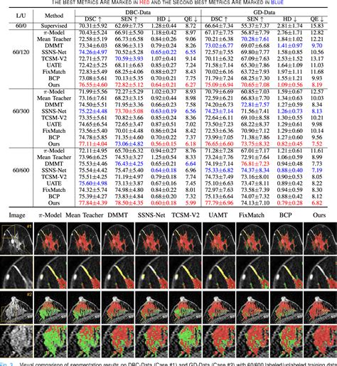 Table IV From Breast Fibroglandular Tissue Segmentation For Automated