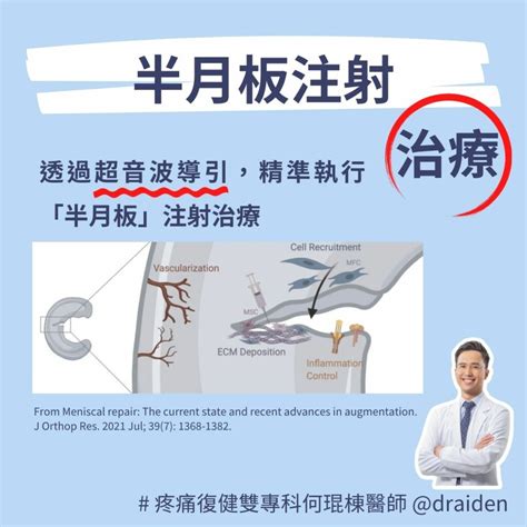 半月板損傷一定要開刀嗎？膝蓋積水如何消？ 何琨棟醫師 Dr Aiden