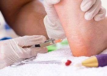 Foot Pain Non Surgical Treatment For Foot Injuries Shoreview