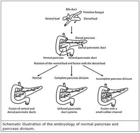Omtex Classes Draw Neat Labelled Diagram Of The Pancreas