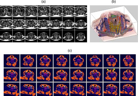 Overview Of Diffuse Optical Tomography And Its Clinical Applications