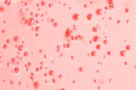 Metronidazole Causes Bleeding