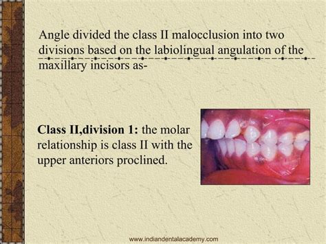 Angles Class 2 Malocclusion Ppt